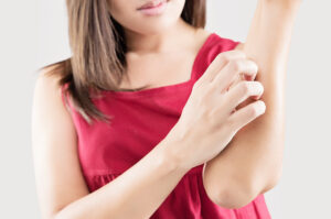 Keto Rash: What Causes It, Treatment, and Prevention – Kiss My Keto Blog